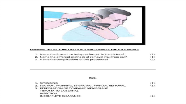 ENT ospe 1 .pdf .....good and easy for medical | PDF | Ear, Nose and Throat Conditions ...