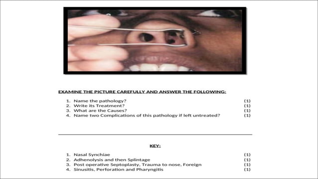 ENT ospe 1 .pdf .....good and easy for medical | PDF | Ear, Nose and Throat Conditions ...