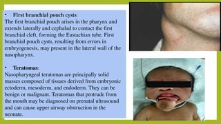 anatomy and physiology of pharynx ( oro and naso and pharyngeal) | PPTX