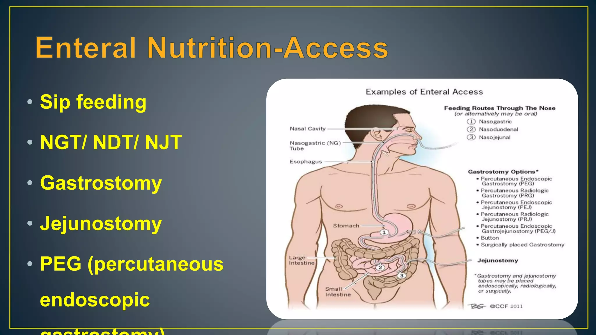 Enteral & Parenteral nutrition | PPTX