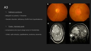 ENT Post graduate MCQ PRACTICE SET 1.pptx