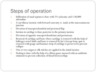 septoplasty and smr | PDF