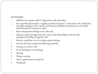 septoplasty and smr | PDF