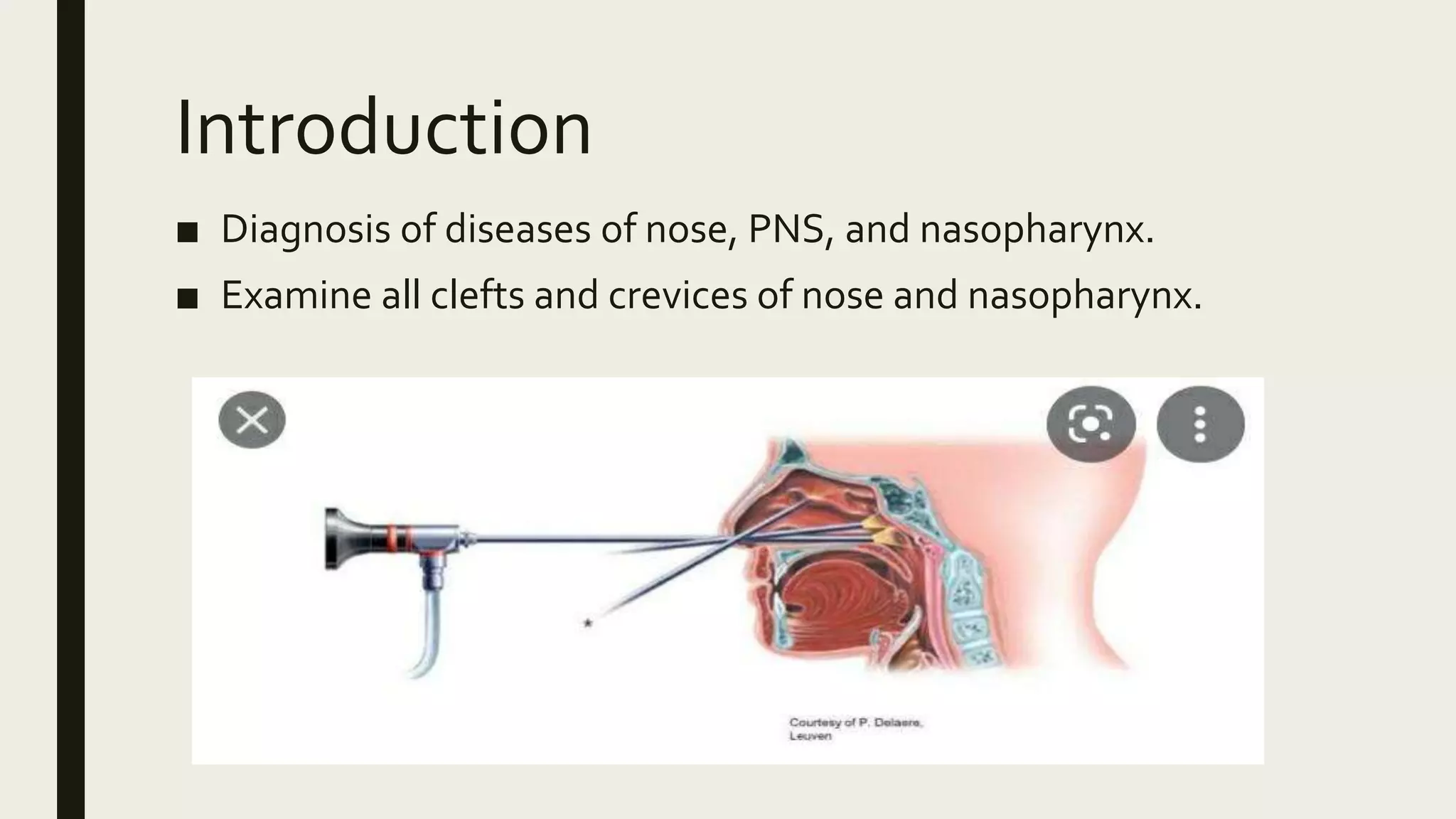 diagnostic nasal endoscopy | PPTX