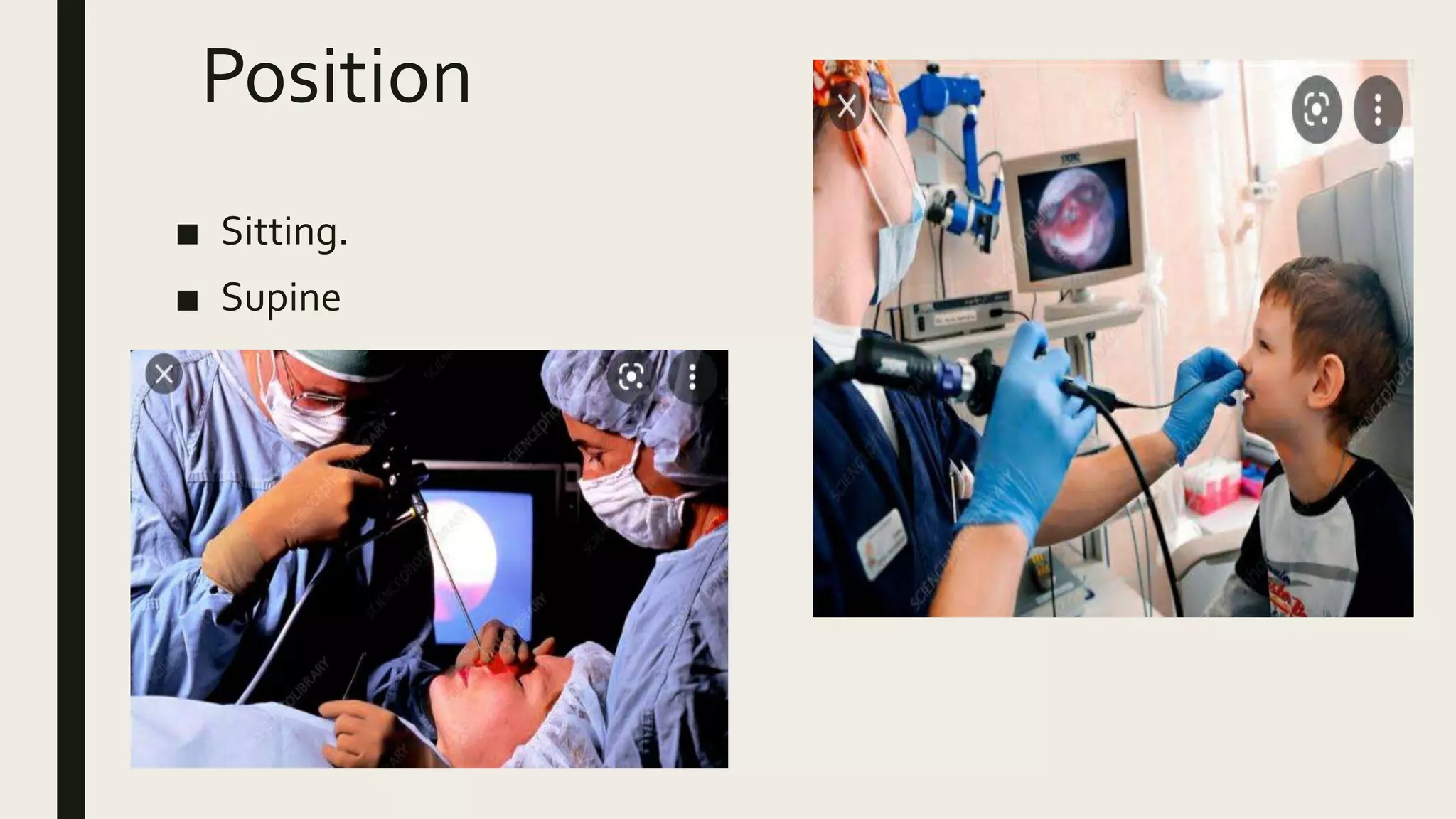 diagnostic nasal endoscopy | PPTX