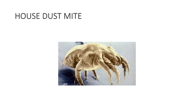 ENT PROBLEMS IN CHILDREN. .pptx