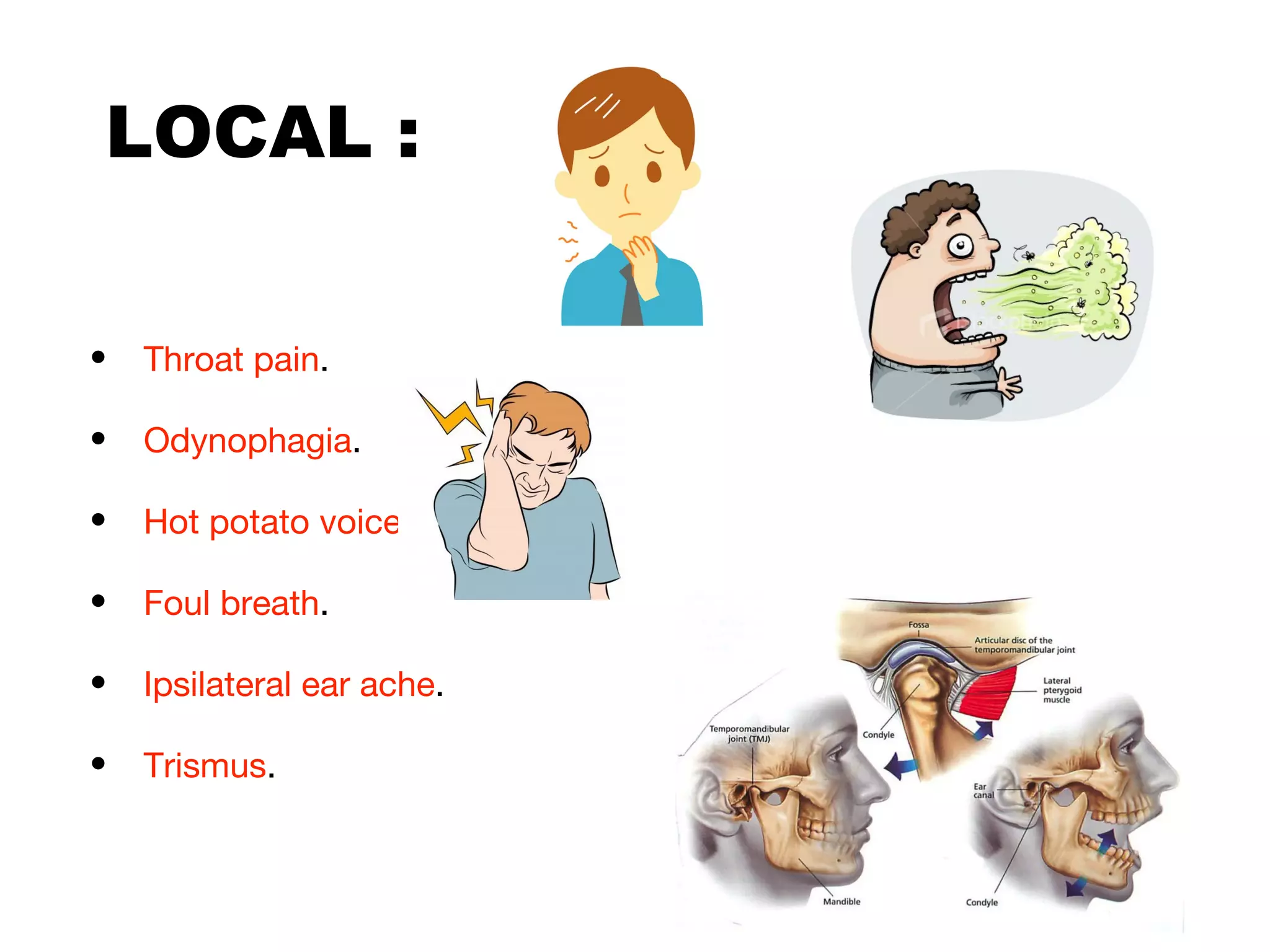 QUINSY (Peritonsillar Abscess) | PPT