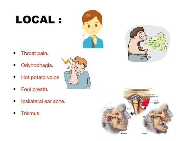 QUINSY (Peritonsillar Abscess) | PPT