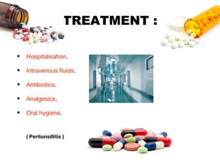 QUINSY (Peritonsillar Abscess) | PPT