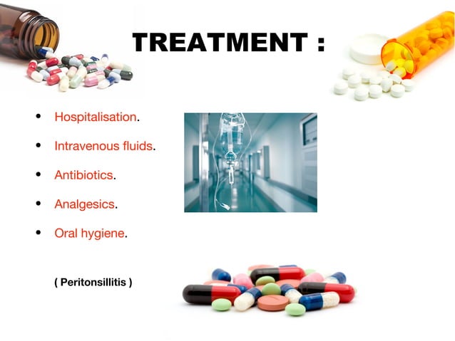 QUINSY (Peritonsillar Abscess)