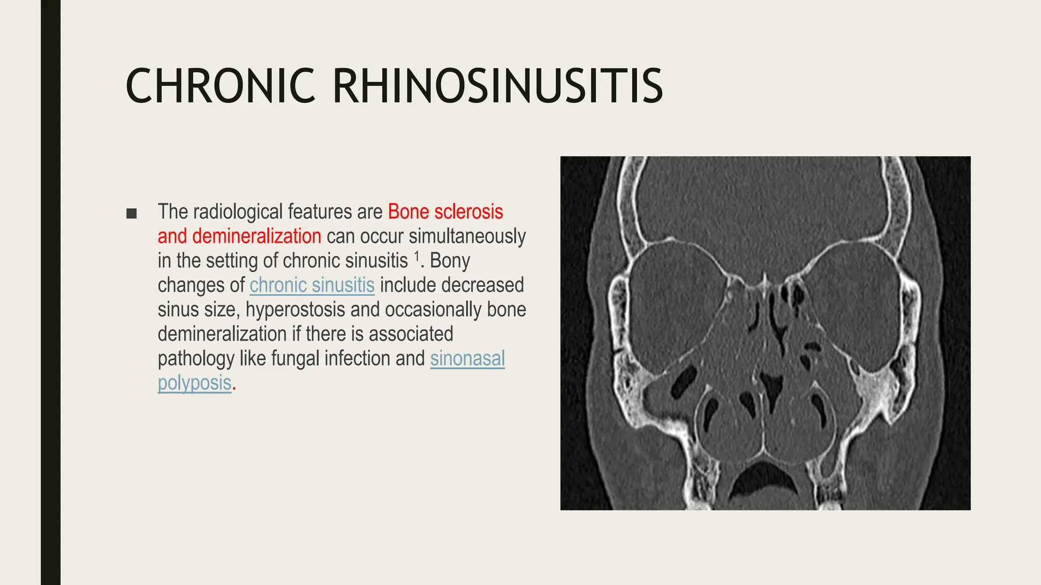 EAR NOSE THROAT BASIC RADIOLOGICAL INTERPRETATION RADIOLOGY.pptx