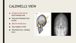 EAR NOSE THROAT BASIC RADIOLOGICAL INTERPRETATION RADIOLOGY.pptx