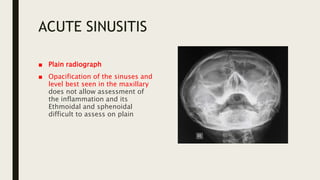 EAR NOSE THROAT BASIC RADIOLOGICAL INTERPRETATION RADIOLOGY.pptx