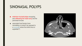 EAR NOSE THROAT BASIC RADIOLOGICAL INTERPRETATION RADIOLOGY.pptx