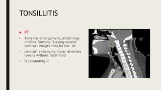 EAR NOSE THROAT BASIC RADIOLOGICAL INTERPRETATION RADIOLOGY.pptx