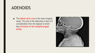 EAR NOSE THROAT BASIC RADIOLOGICAL INTERPRETATION RADIOLOGY.pptx