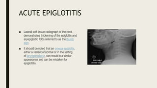 EAR NOSE THROAT BASIC RADIOLOGICAL INTERPRETATION RADIOLOGY.pptx