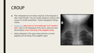 EAR NOSE THROAT BASIC RADIOLOGICAL INTERPRETATION RADIOLOGY.pptx
