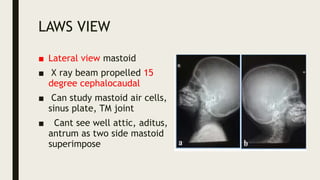 EAR NOSE THROAT BASIC RADIOLOGICAL INTERPRETATION RADIOLOGY.pptx