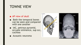 EAR NOSE THROAT BASIC RADIOLOGICAL INTERPRETATION RADIOLOGY.pptx