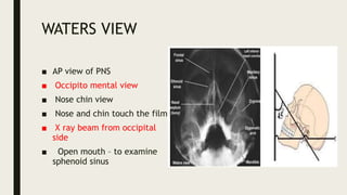EAR NOSE THROAT BASIC RADIOLOGICAL INTERPRETATION RADIOLOGY.pptx