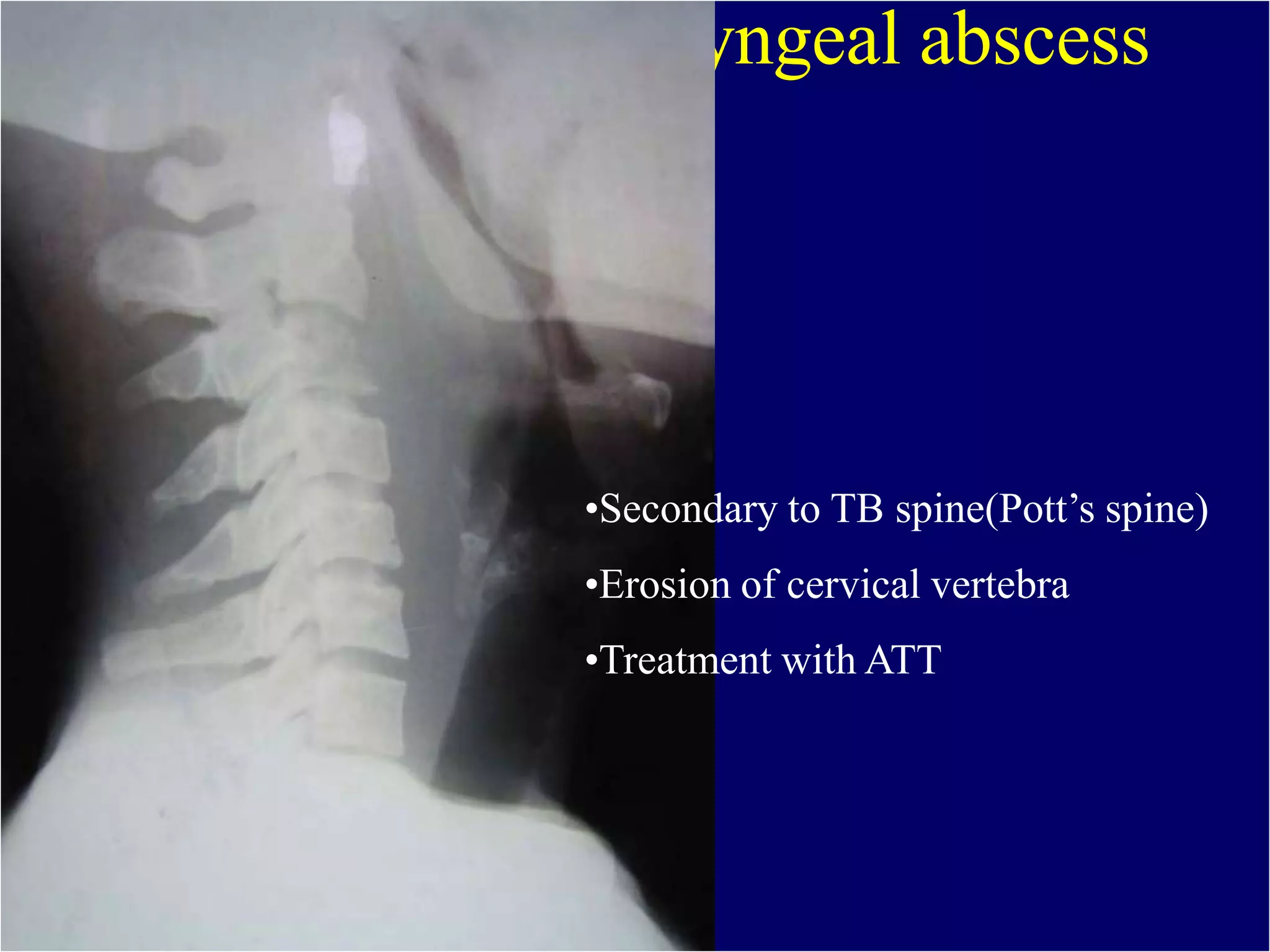 Ent radiology | PPTX