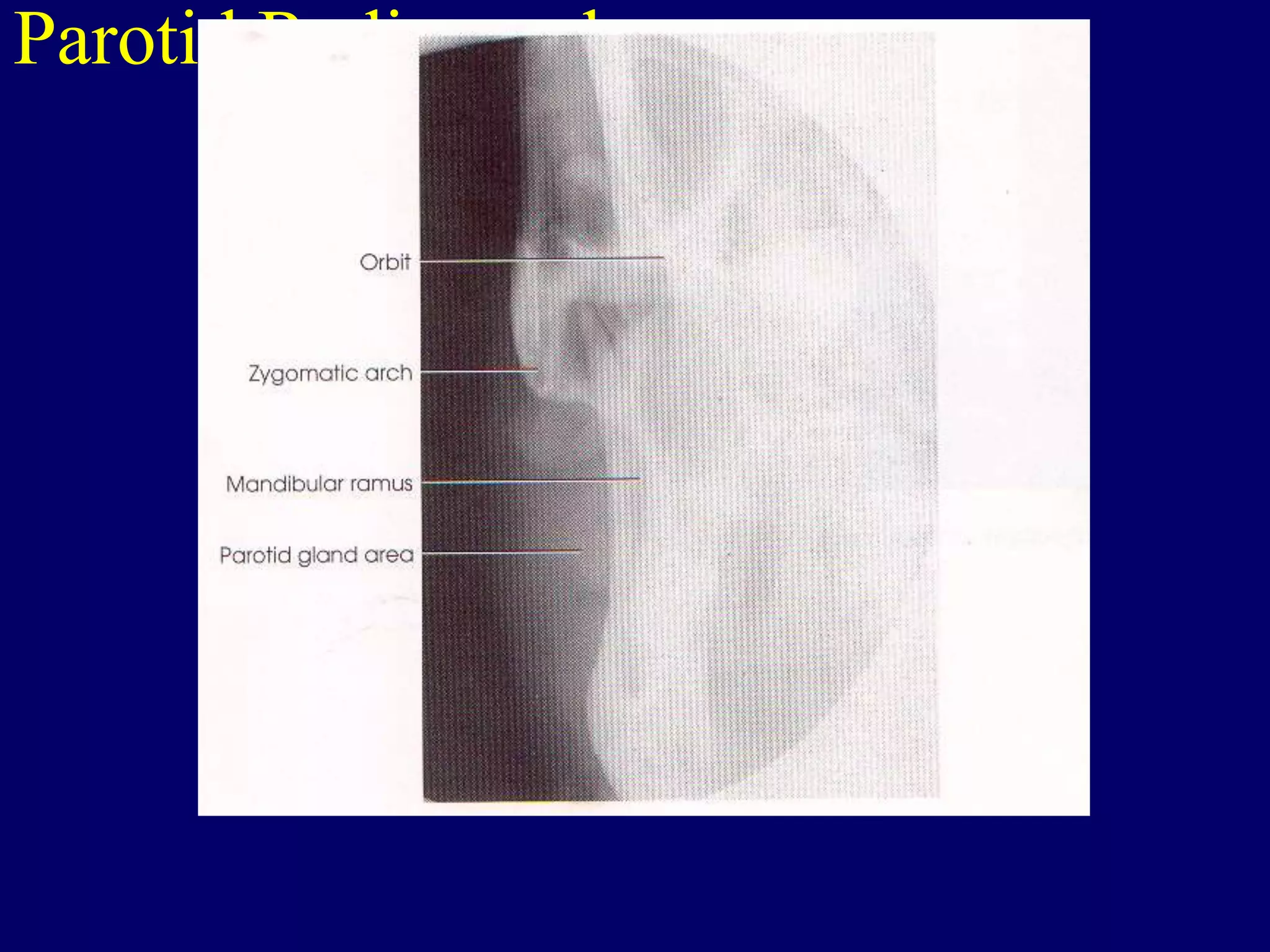 Ent radiology | PPTX