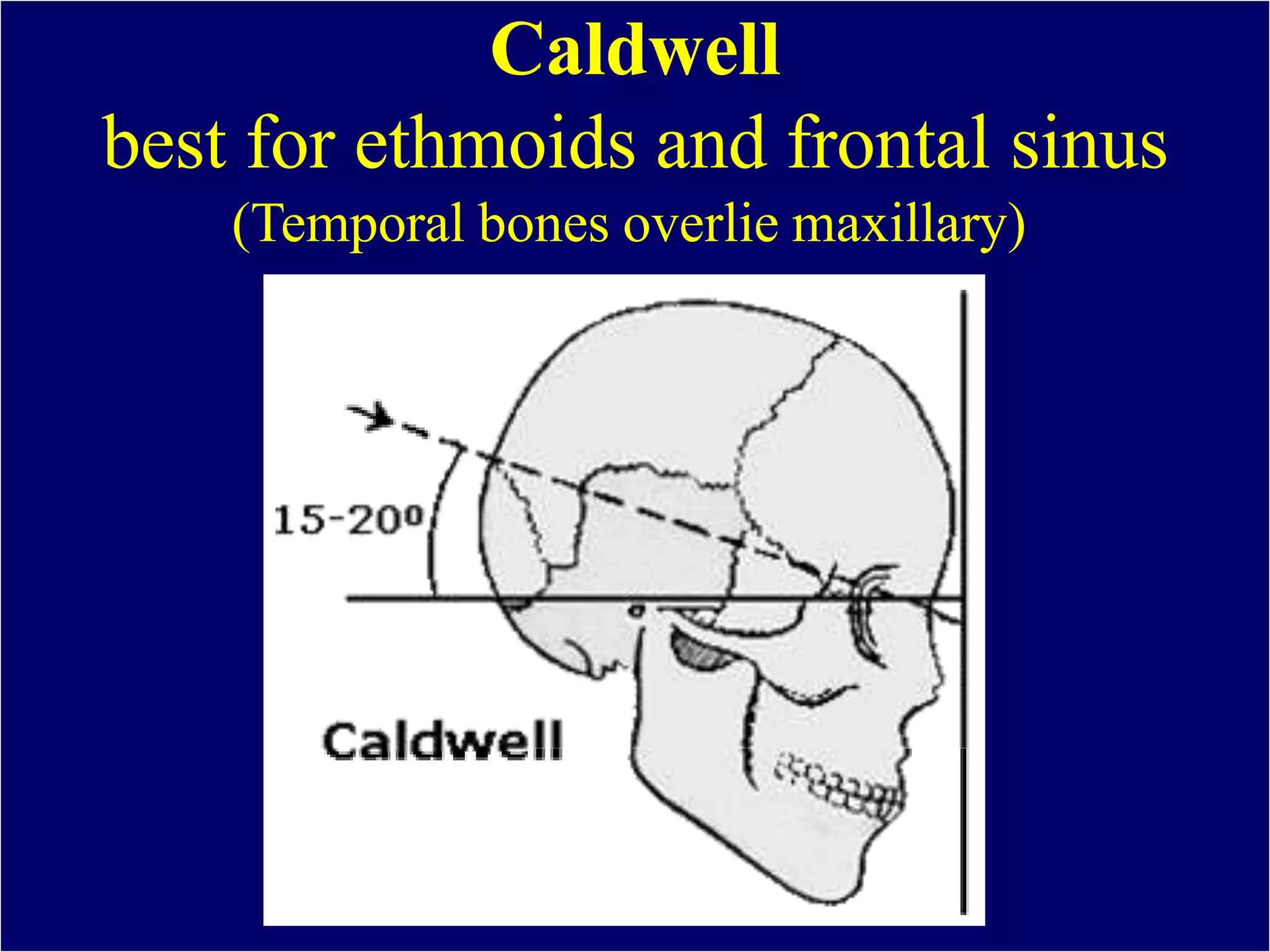 Ent radiology | PPTX