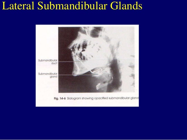 Esophageal Web With Proximal Dilatation And Diverticulum