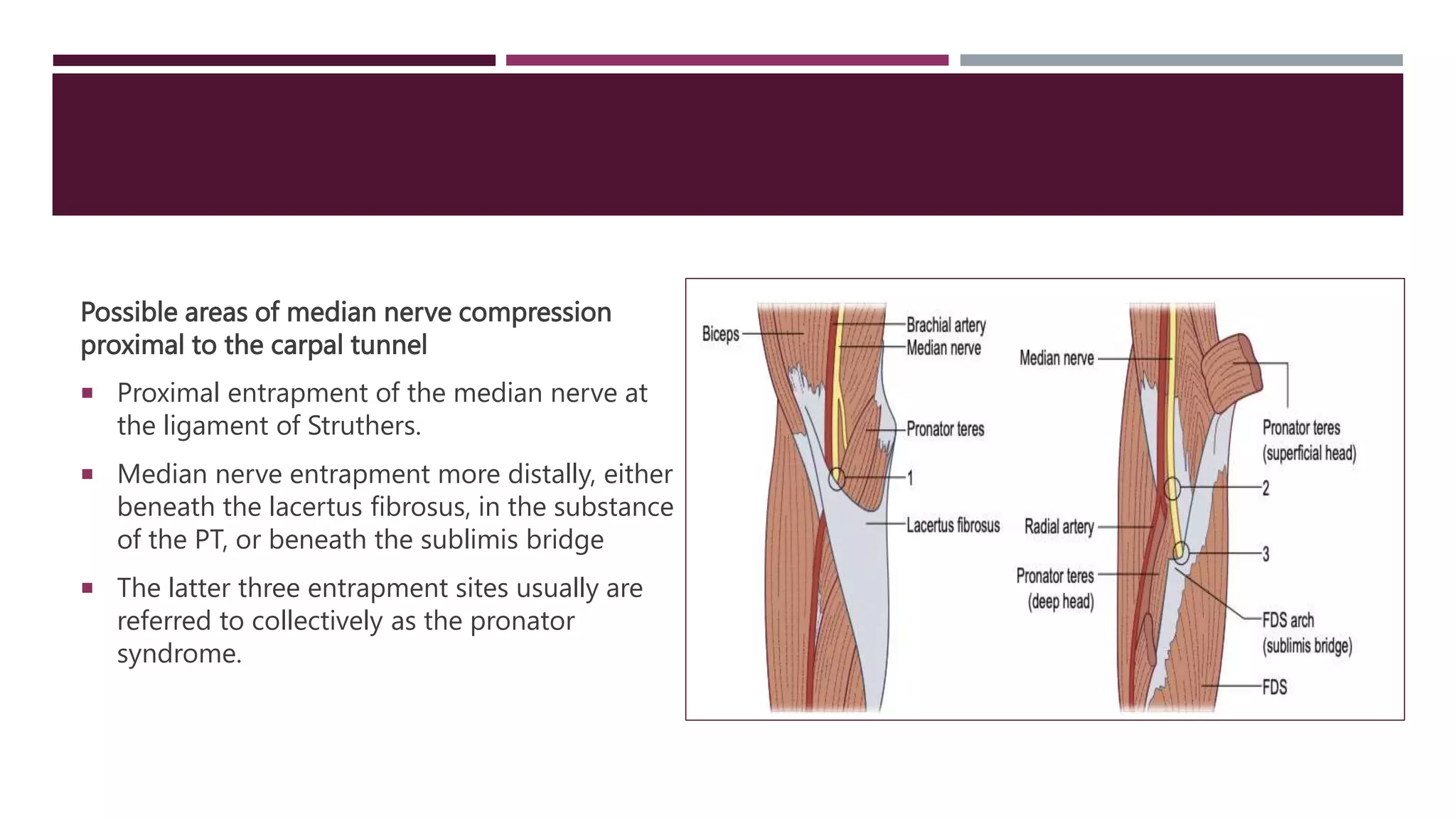 Entrapment Neuropathies in Upper Limb.pptx
