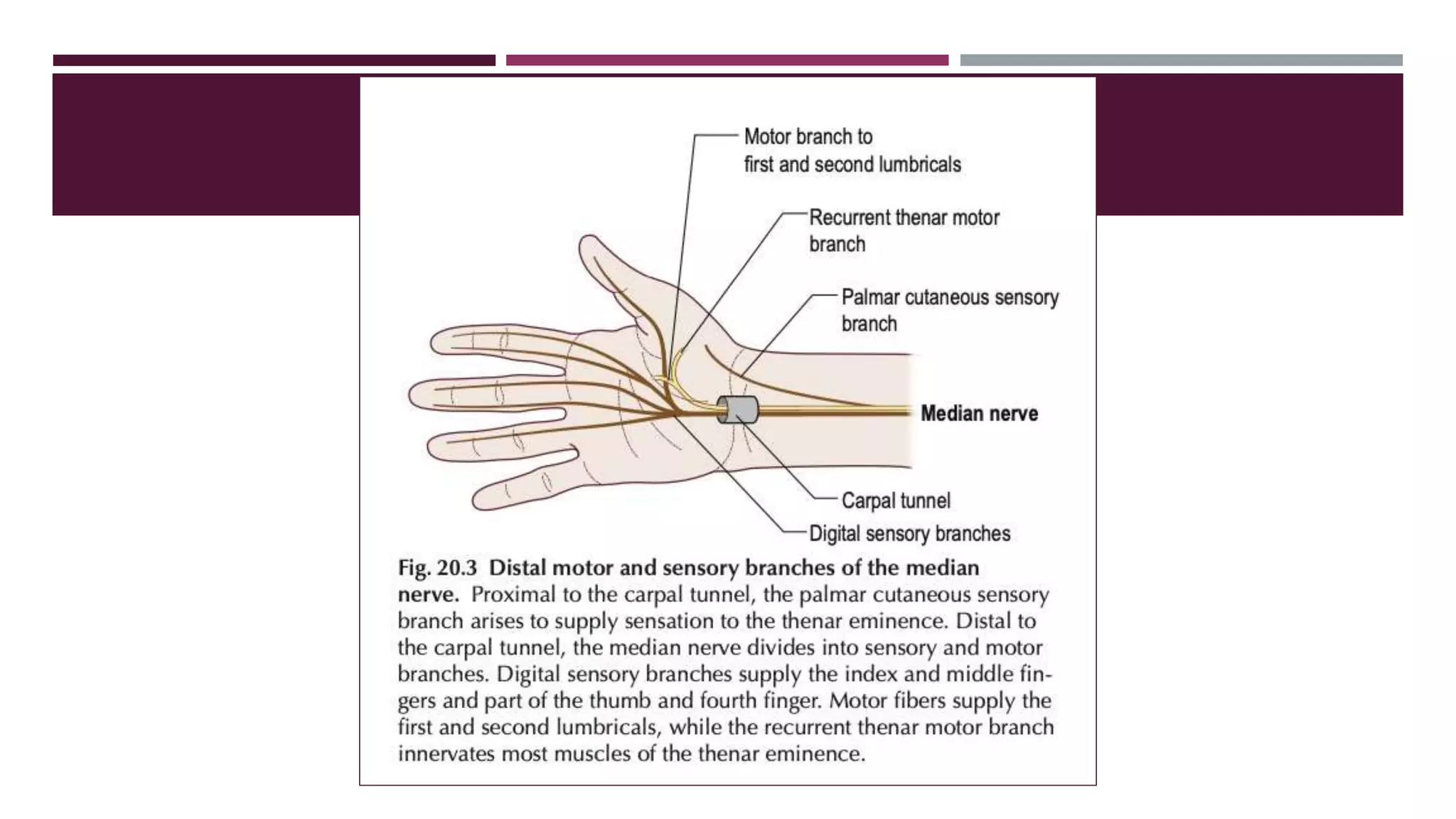 Entrapment Neuropathies in Upper Limb.pptx