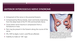 Entrapment Neuropathies in Upper Limb.pptx