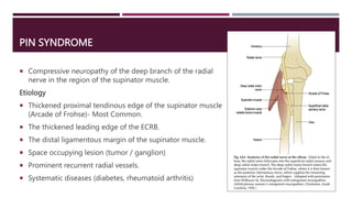 Entrapment Neuropathies in Upper Limb.pptx