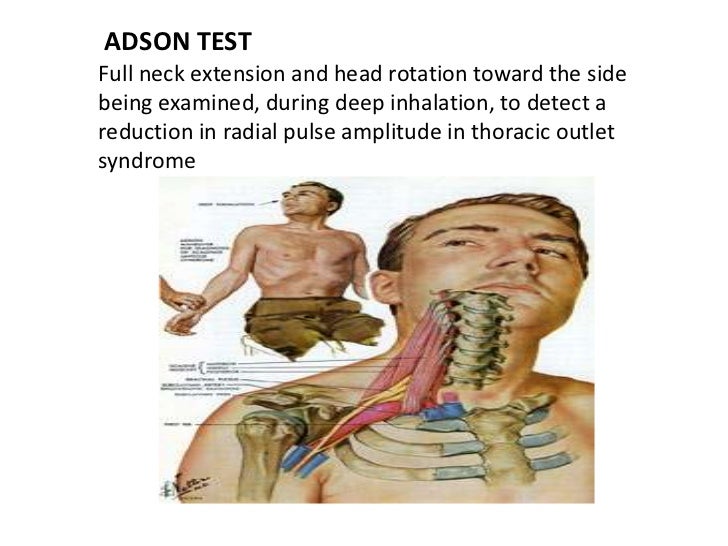 Entrapment neuropathies 28.2.12