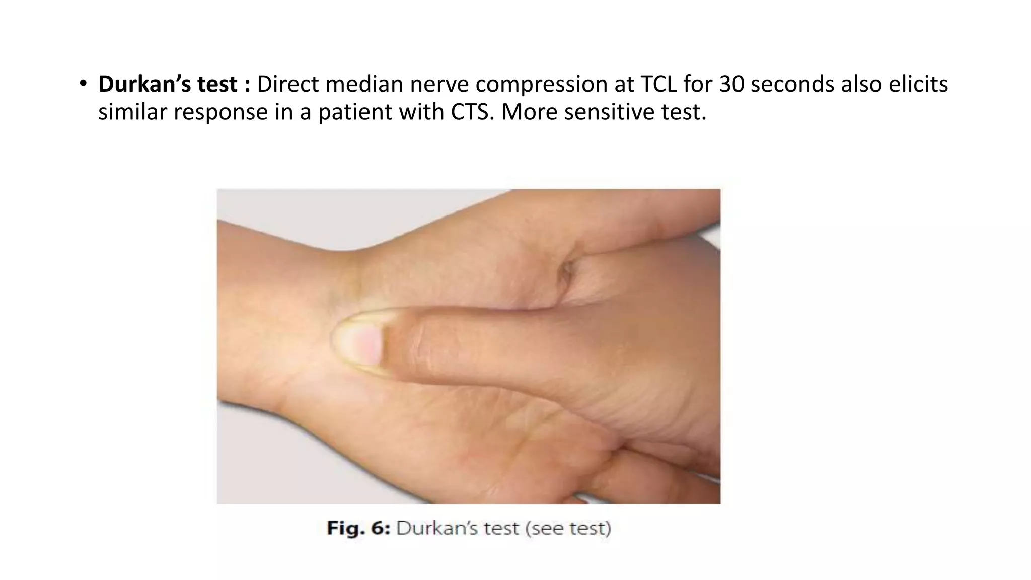 Entrapment neuropathy | PPTX