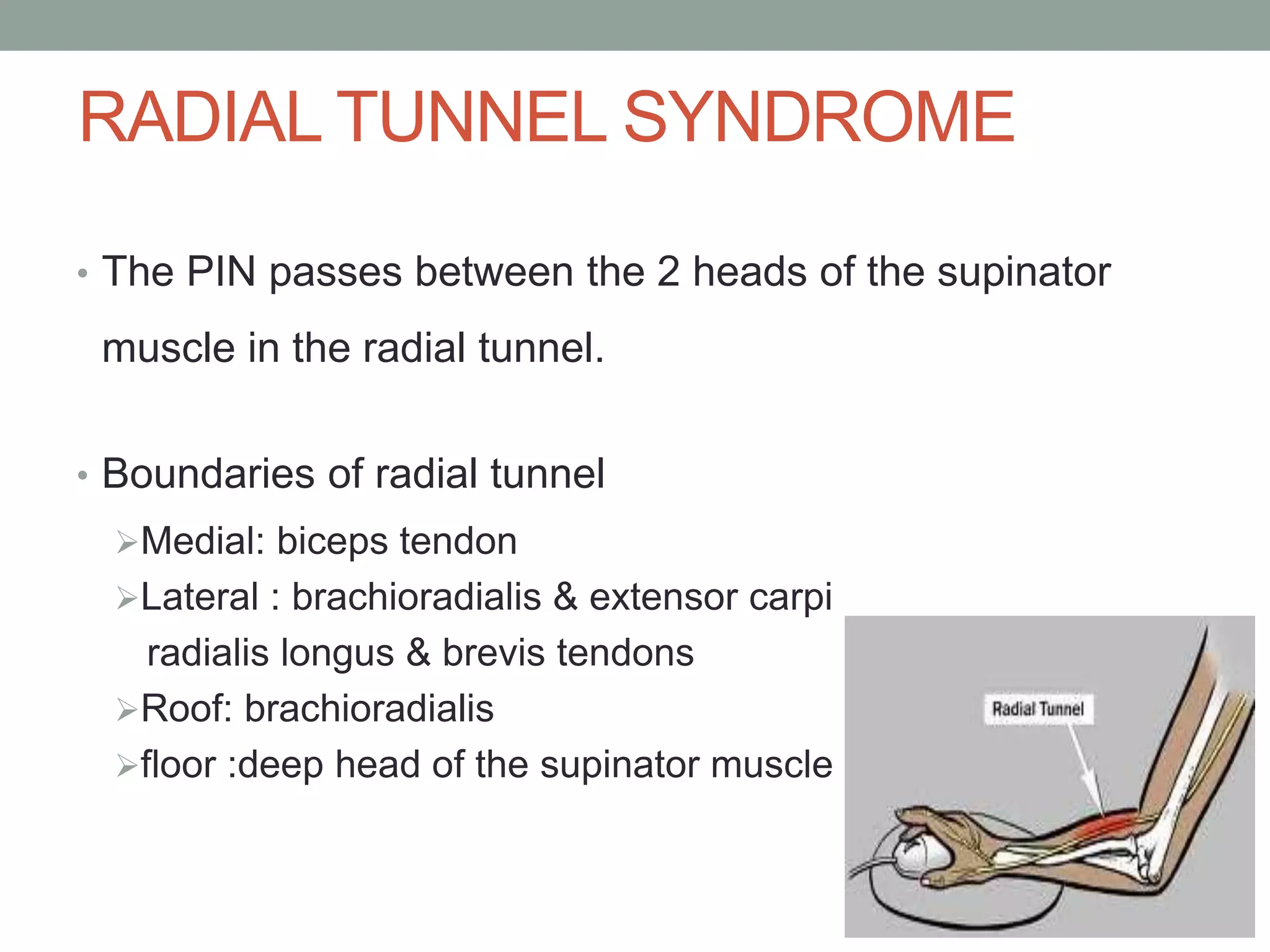 Entrapment neuropathy of the upper limb | PPTX