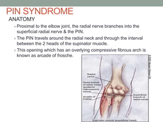 Entrapment neuropathy of the upper limb | PPTX