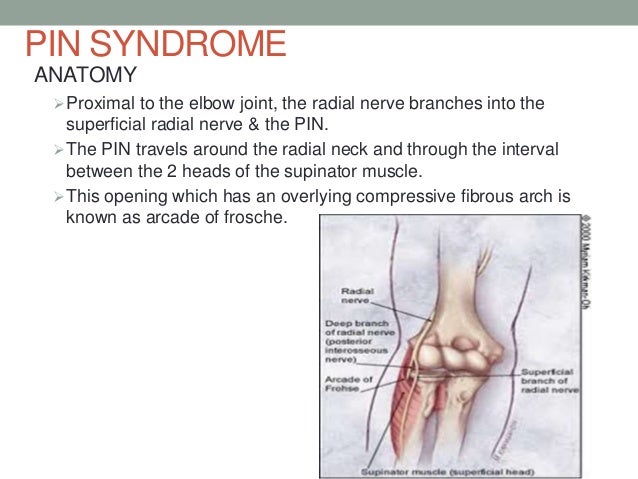 Entrapment neuropathy of the upper limb