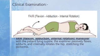 Entrapment Syndromes of Lower Limb.pptx