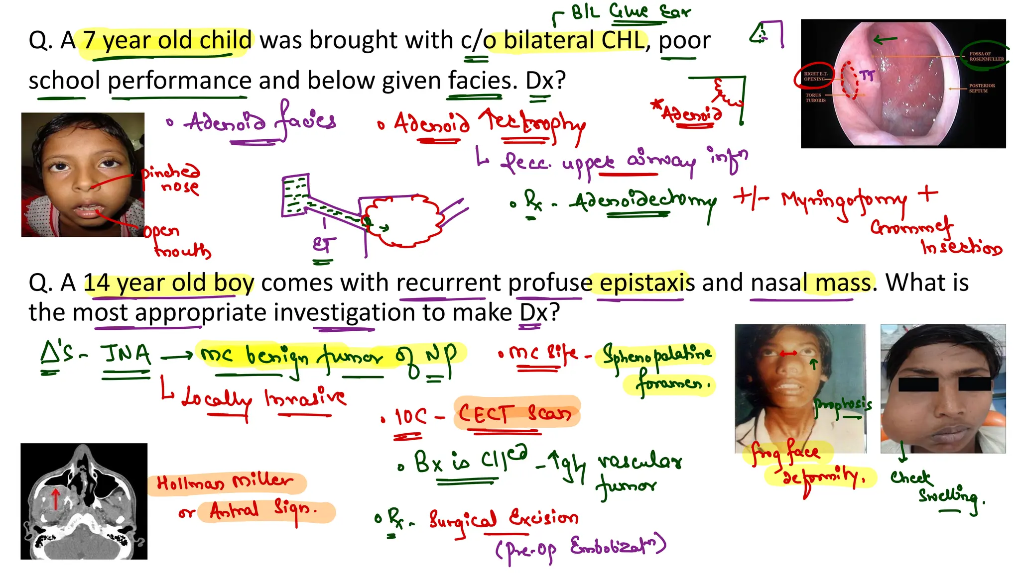 RAPID101111111 ENT REVISION 4TH YEAR.pdf