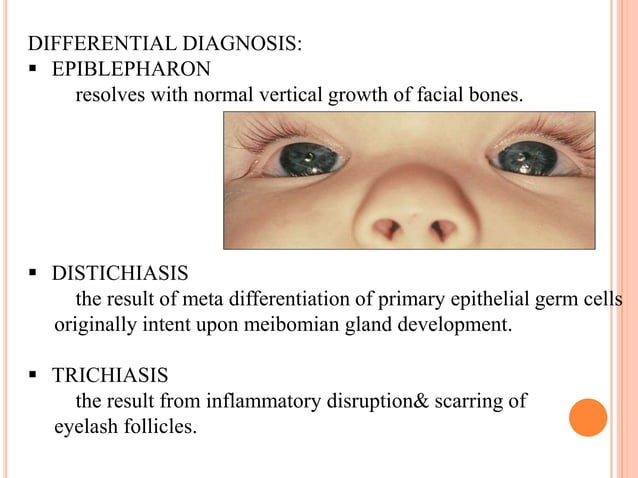Entropion | PPTX | Eye and Vision Conditions | Diseases and Conditions