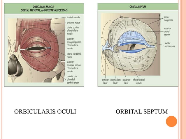 Entropion | PPTX | Eye and Vision Conditions | Diseases and Conditions