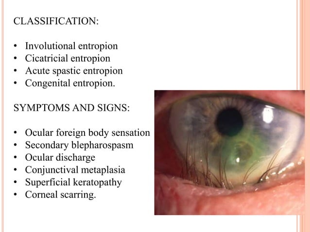 Entropion | PPTX | Eye and Vision Conditions | Diseases and Conditions