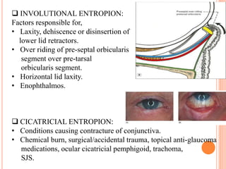 Cicatricial Entropion