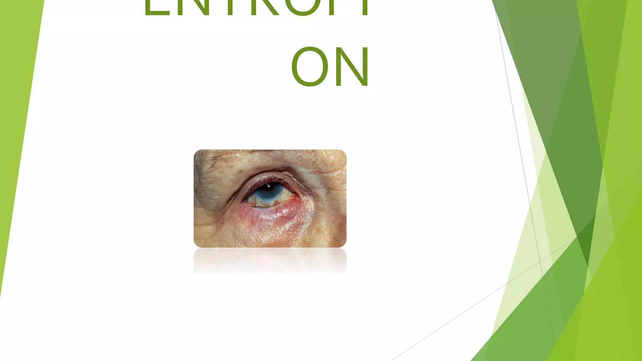 Entropion | PPTX