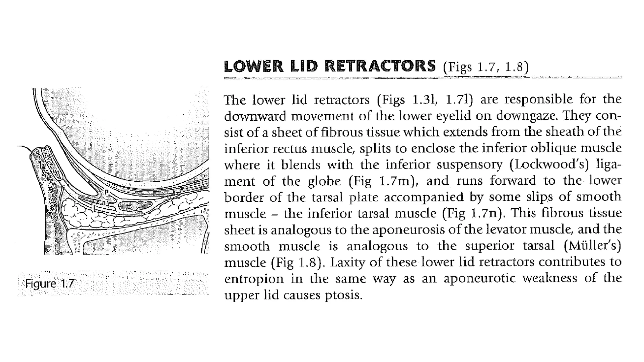 Involutional Entropion-mechanism, evaluation and management (lower lid ...