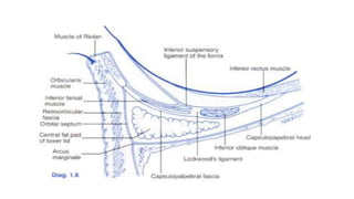 Involutional Entropion-mechanism, evaluation and management (lower lid ...