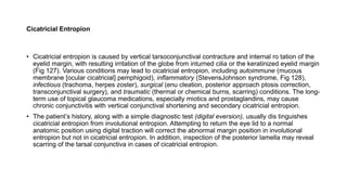 Entropion.pptx