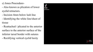 ENTROPION in detailed analysis and management | PPTX