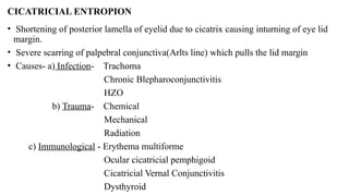 ENTROPION in detailed analysis and management | PPTX